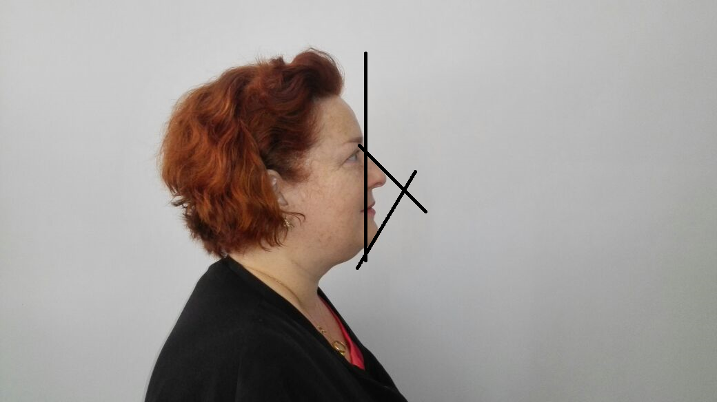 La tijera de oro: ANÁLISI DE LA MORFOLOGIA DEL ROSTRO