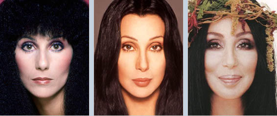 Cher plastic surgery Before and After Botox and Nose Jobs (Star plastic ...