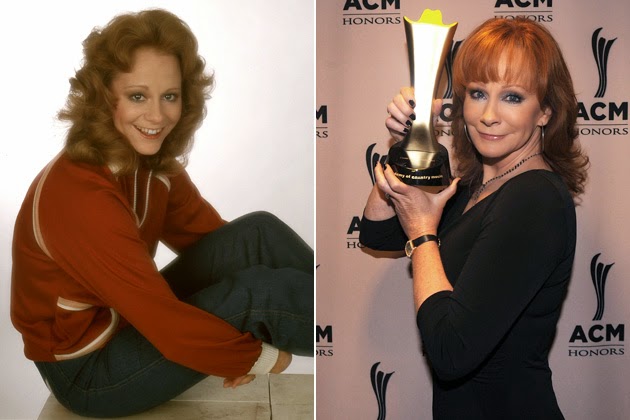 Reba McEntire Plastic Surgery