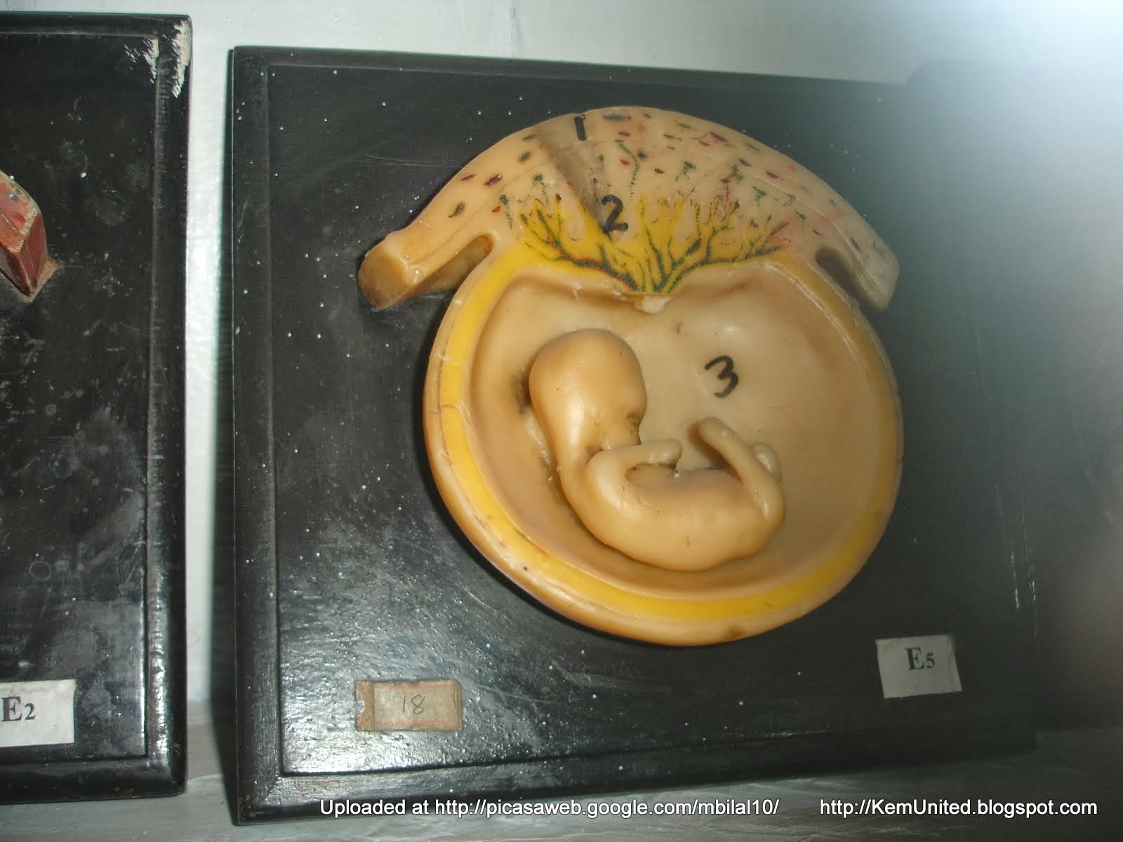 Embryology Models (some are labelled)