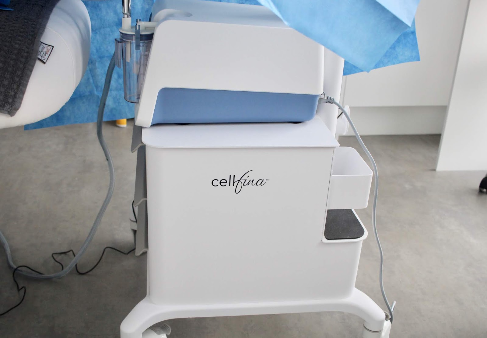 Cellfina - A treatment for cellulite that actually works? My Results ...