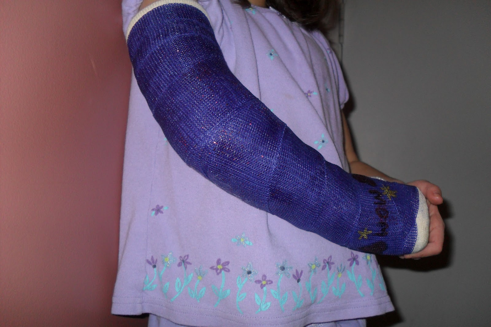 Cast & Blood Work « All Around The Circle