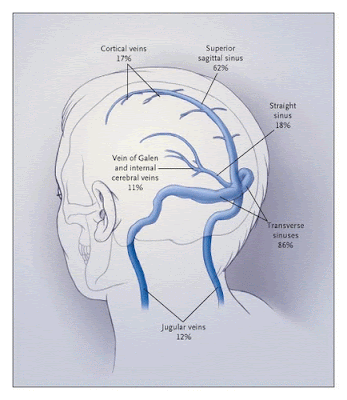 neuropathology blog: Best Post of March 2017: Why is the confluence of ...