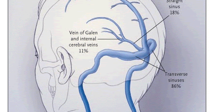 neuropathology blog: Best Post of March 2017: Why is the confluence of ...