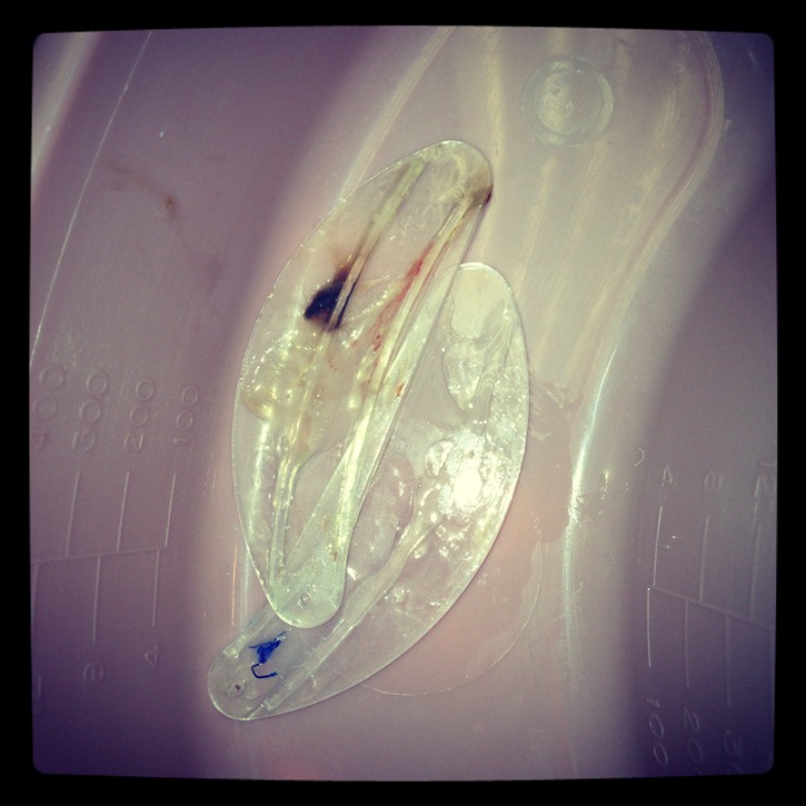 Sunshine!: My Septoplasty Experience