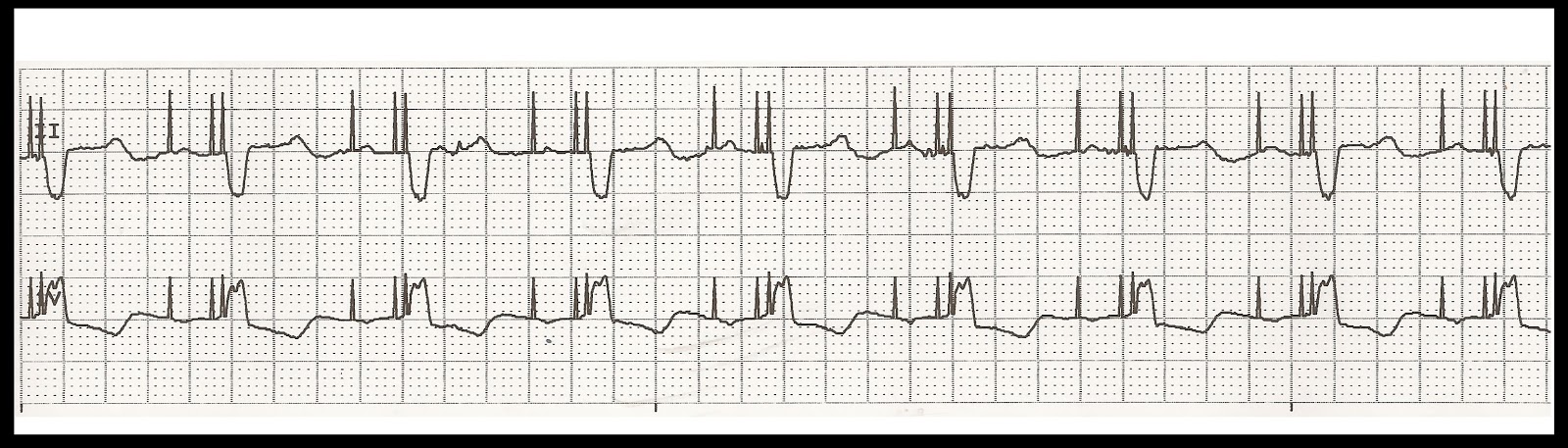 Basic EKG Rhythm Test 29