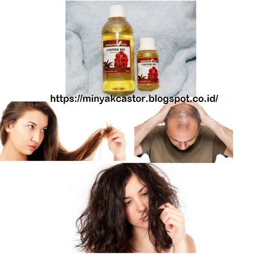 Cara Mengatasi & Perawatan Rambut Rontok