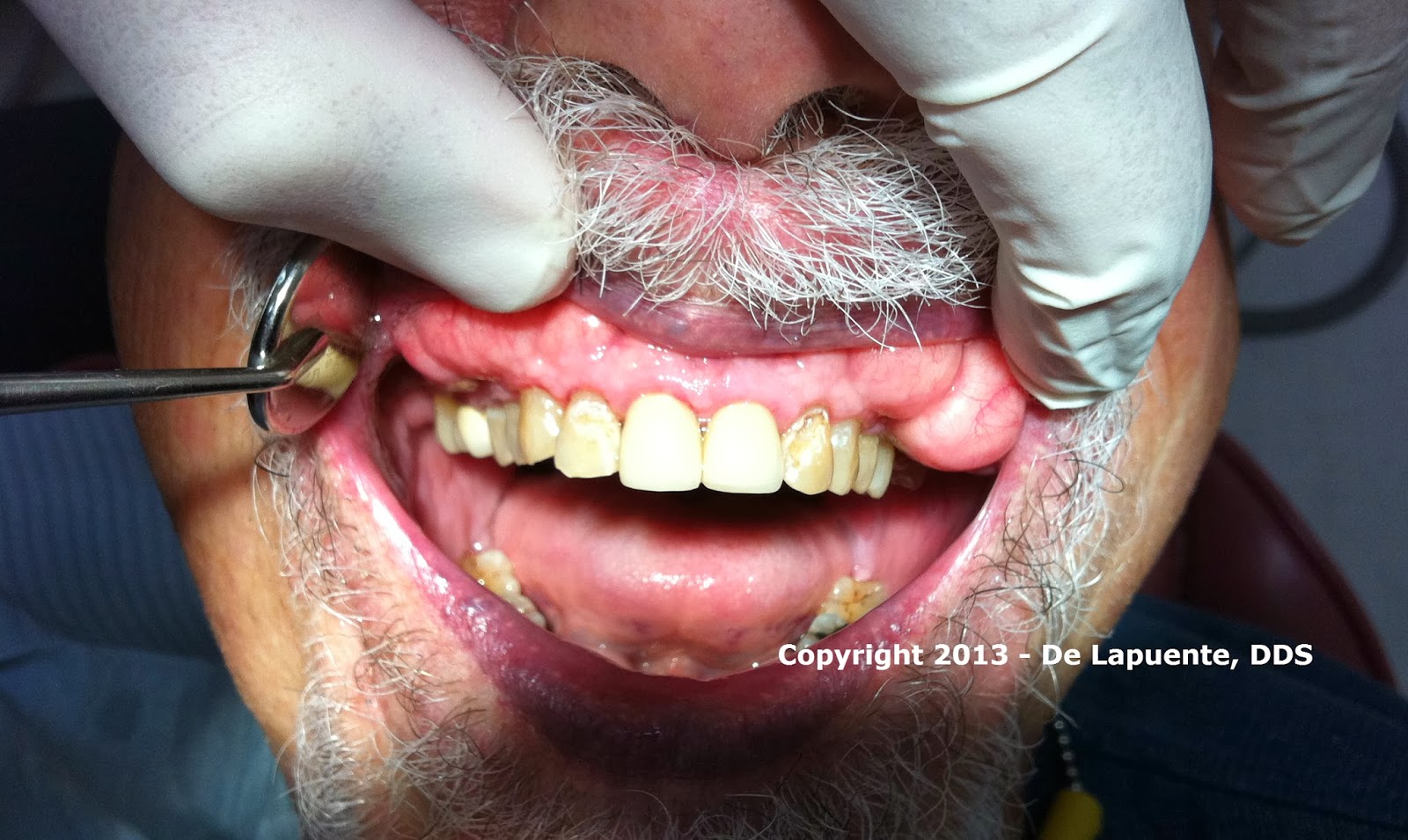 Diagnosing Oral & Maxillofacial Pathologies in My Residency