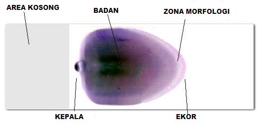 Cara Pembuatan Apusan Darah Tepi
