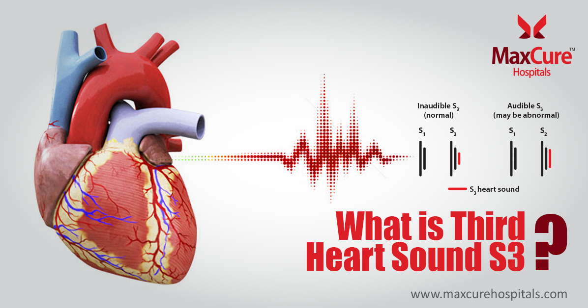 MaxCure Hospitals Hyderabad: What is third heart sound?