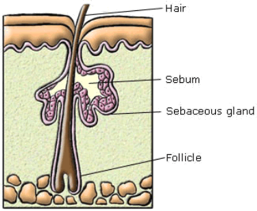 Acne Prone Pores - Difference between normal and obstructed Follicles ...