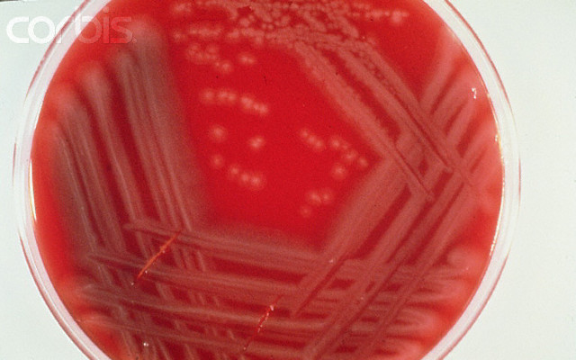 Bug Blog: Lab 3: Sputum Cultures