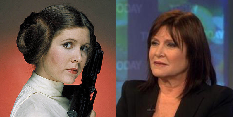 Carrie Fisher Plastic Surgery