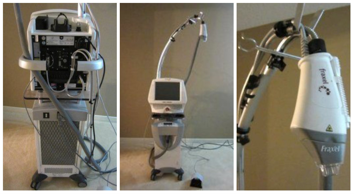 Rock Bottom Lasers: Uses of Alma Lasers