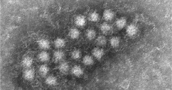 Understanding Anelloviruses