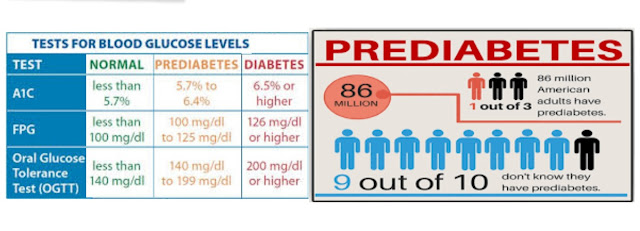 Sliding Scale Regimen of Diabetes