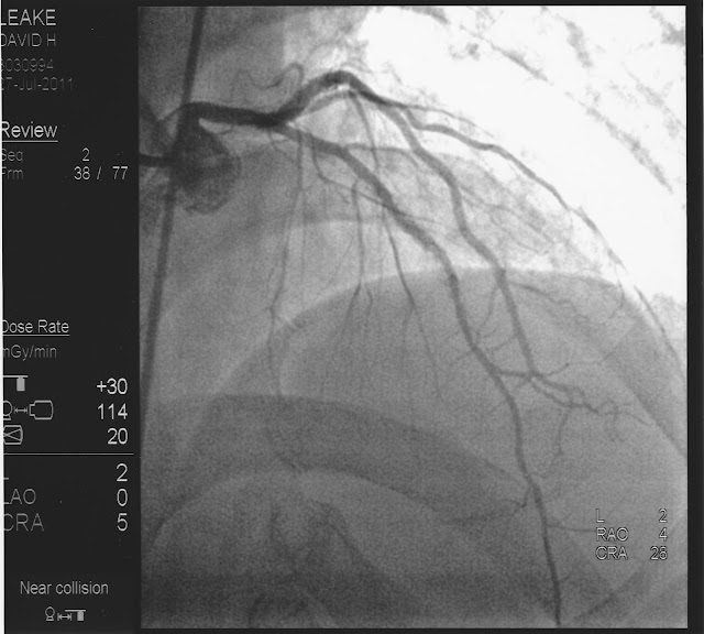 D Leake CAD History 1989 to 2011