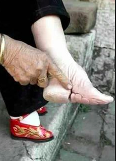 Jean Hatchet: The History Of Hobbling Women.