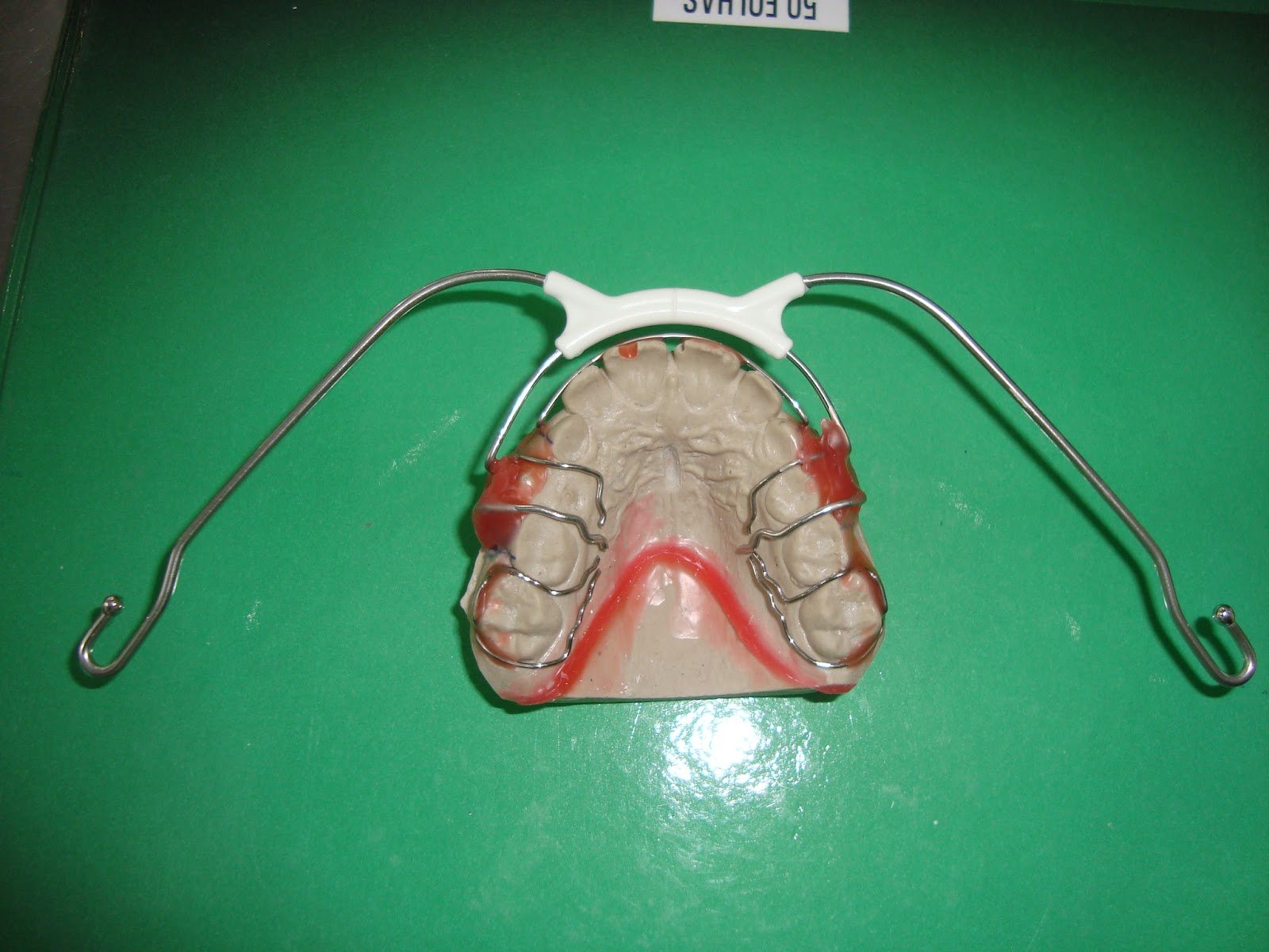 Laboratório Ortodôntico Bohrer: APARELHO THUROW