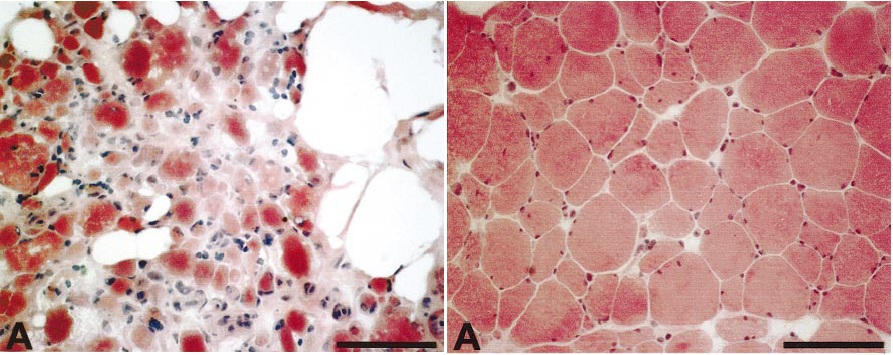 Functional Electrical Stimulation for Denervated Muscle: 2012