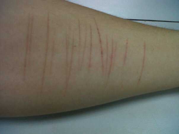 World Without Amicu Ellis: Throw My Hand On A Blade For you..........