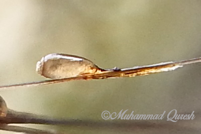 Head Lice Nits | Nature, Cultural, and Travel Photography Blog