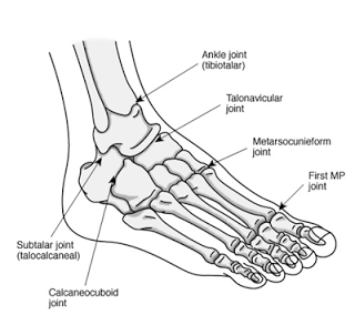 Home: Kaki Pengkor, CTEV, Club Foot, Treatmen