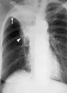 Nos.: Golden S sign.