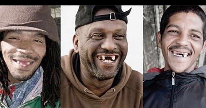 10 Bahaya Gigi Ompong Beserta Cara Mengatasinya | topik terkini