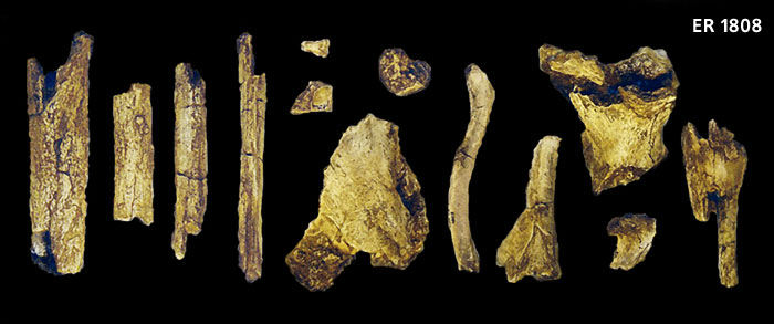 Was Syphylis brought to the Old World by Columbus? (Warning: Graphic ...