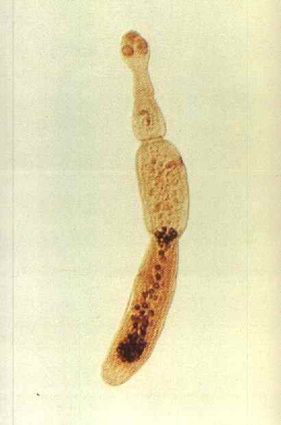 Echinococcus - JungleKey.fr Image