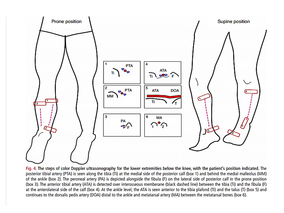 BÀI SOẠN VỀ SIÊU ÂM CHẨN ĐOÁN: Doppler Ultrasonography of the Lower ...
