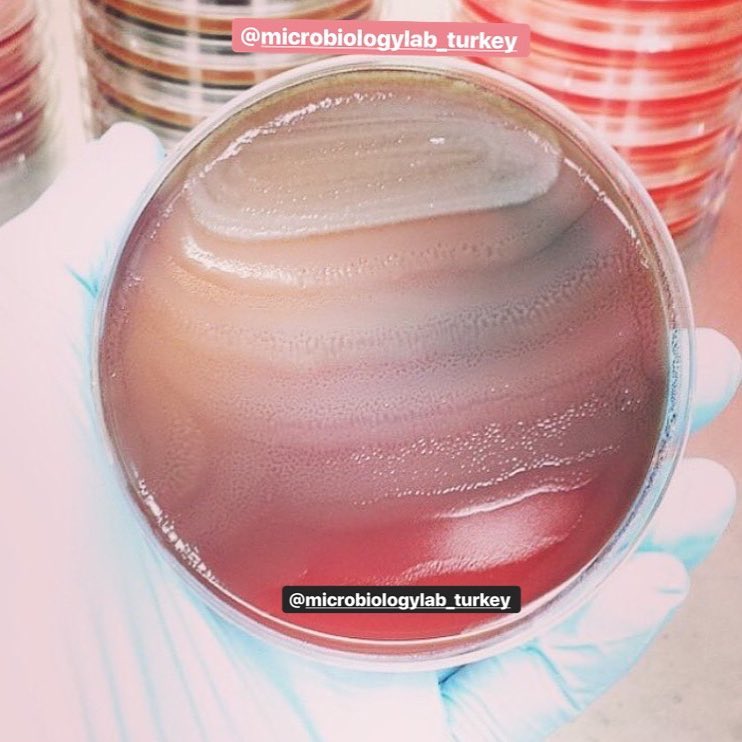 PROTEUS SPP. (TÜRKÇE) - Microbiology Laboratory Turkey