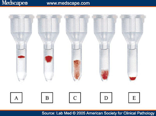 Medical Laboratory and Biomedical Science: Comparison between ...