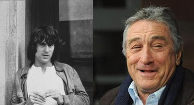 Al Pacino Plastic Surgery Before and After Botox Injections and ...