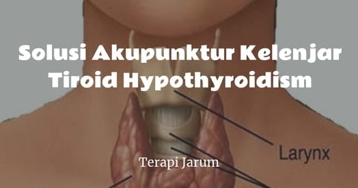 Solusi Akupunktur Kelenjar Tiroid Hypothyroidism - Terapi Jarum