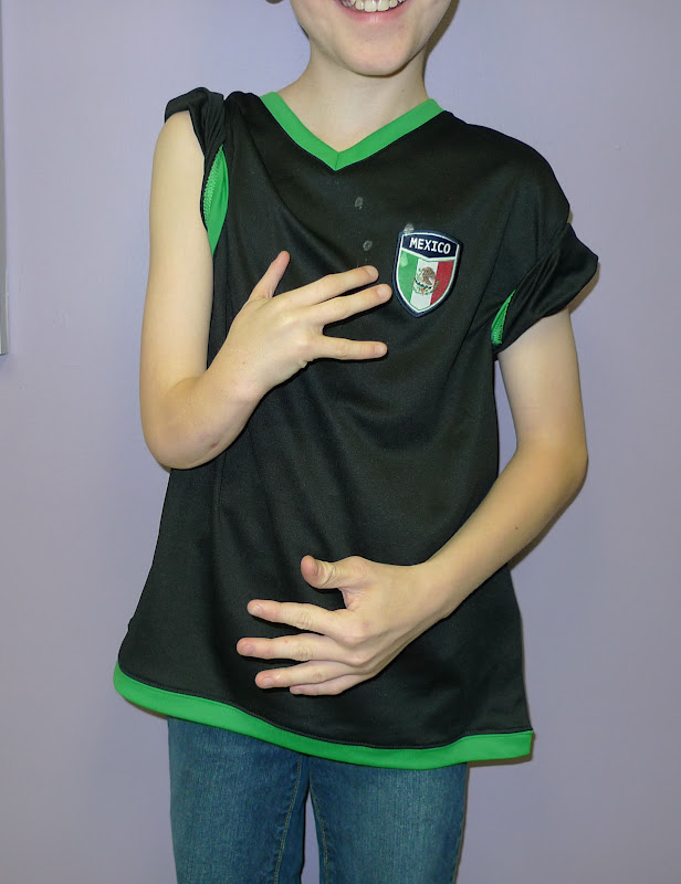 Form and Function in Radial Deficiency | Congenital Hand and Arm ...