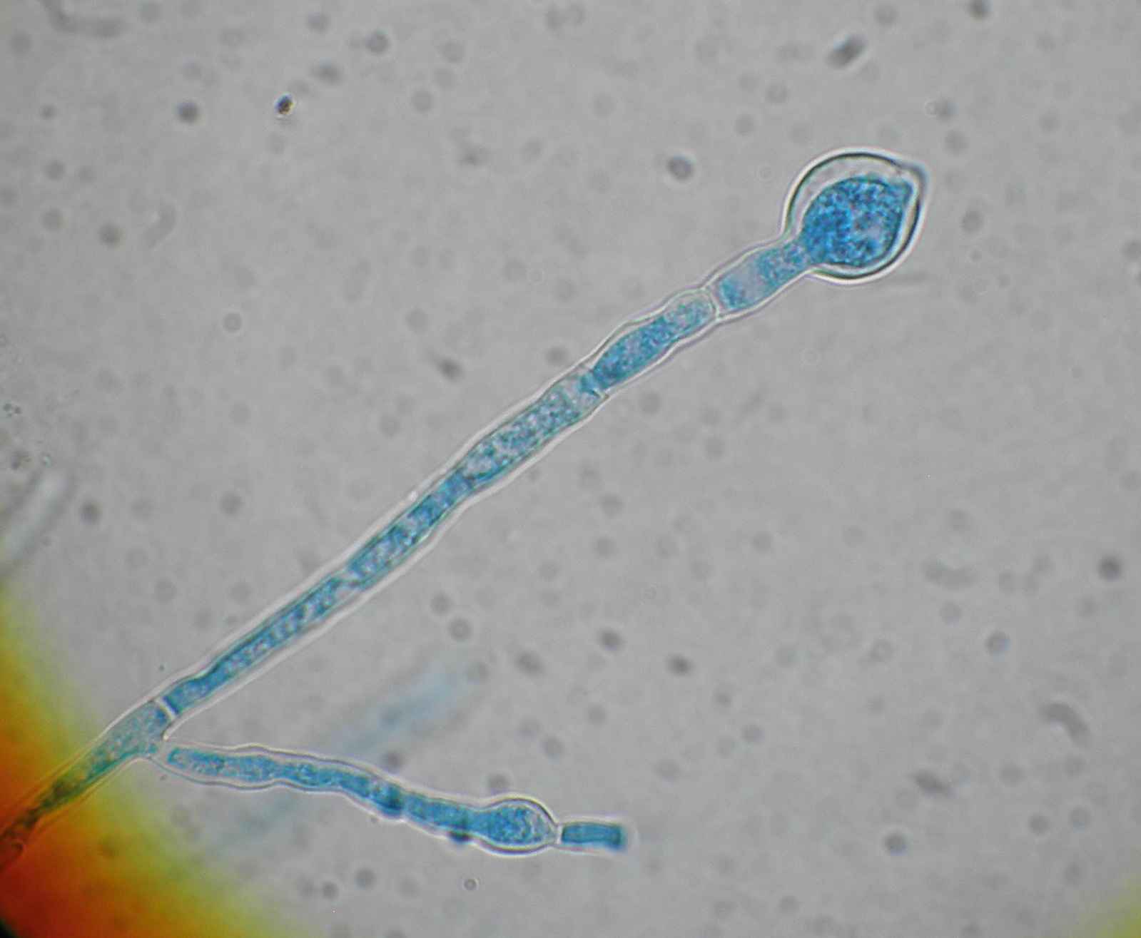 ATLAS MICOLOGIA: MICROSPORUM AUDOUINII