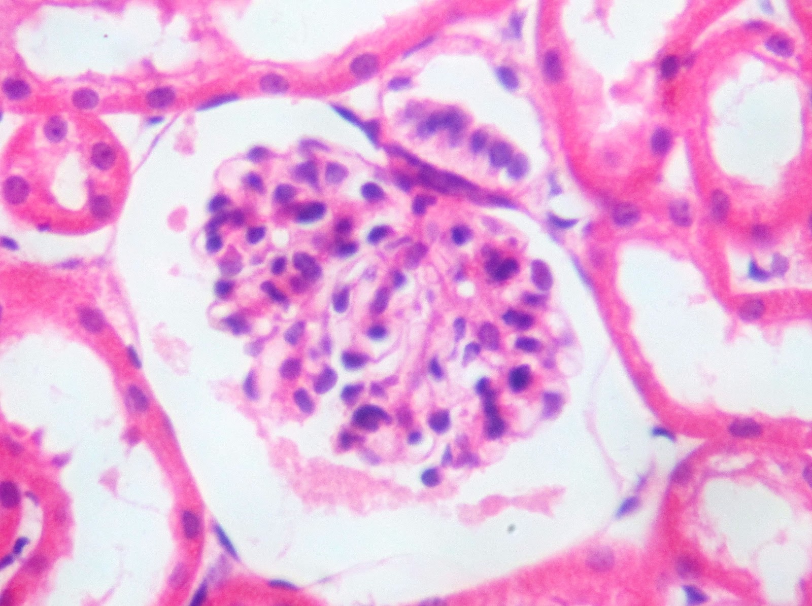 morfologia e histologia do Rim