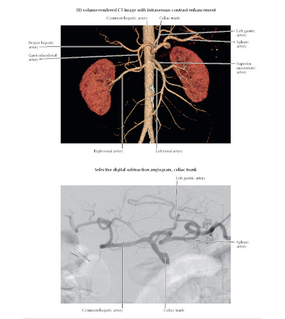 Celiac Arteriogram and CT Angiogram Anatomy - pediagenosis