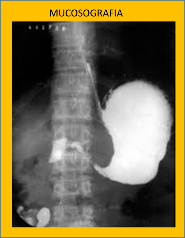 ESTUDIOS ESPECIALES GASTROINTESTINALES : ESTUDIOS ESPECIALES ...