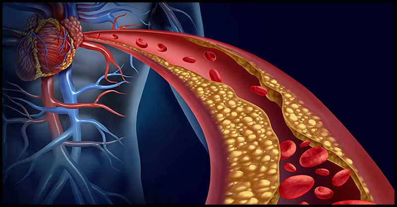 Foods That May Help Improve Blood Circulation | Dr Farrah MD