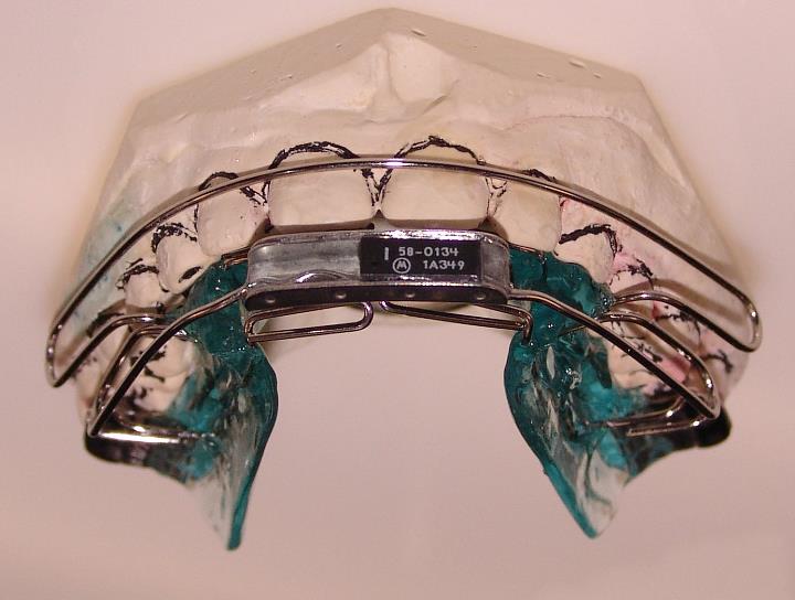 Ortopedia Funcional de los Maxilares: …APRÉNDELO TODO SOBRE EL APARATO ...