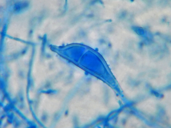 Fun With Microbiology (What's Buggin' You?): Microsporum audouinii