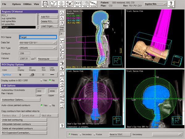 RADIOLOGIA IN FOCO: Pinnacle3 Proton Therapy System ganha aprovação da ...