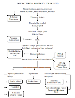 assova: SNNT (Struma Nodusa Non Toksik)