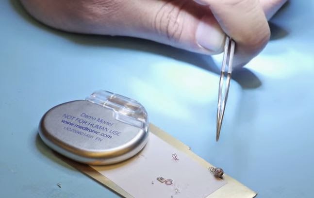 Mark Turner's Mysterious World: New Wireless Micro Medical Implant ...