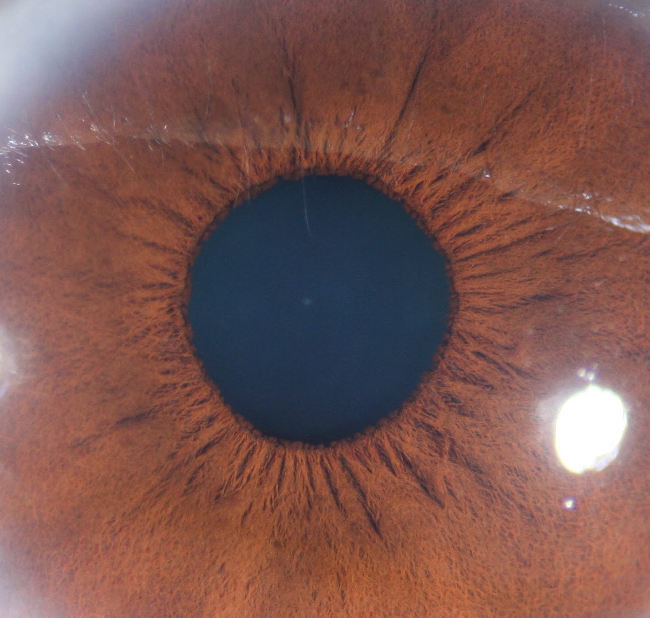 Modern & Multidimensional Iridology: Space Deficiency, IPB Spinal ...