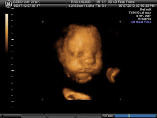 My First Year As Mrs G Beecham & Beyond: So Much To Tell...Very ...