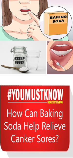 How Can Baking Soda Help Relieve Canker Sores World Of Health